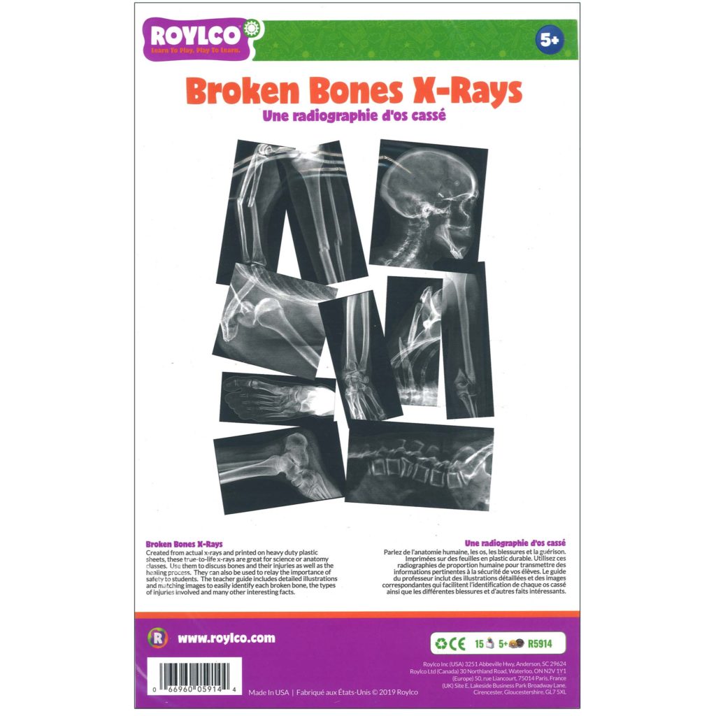 Broken Bones X-Ray Set - Captivating Science